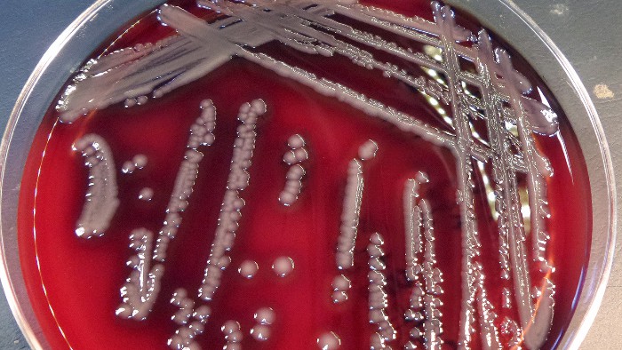 Aeromonas hydrophila , Edisi 30 - Apki